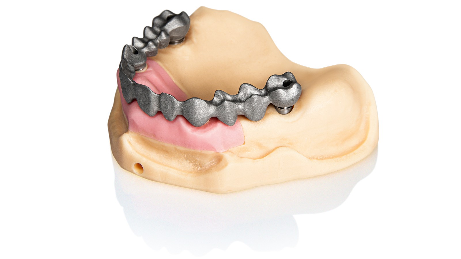 dima Print Stone beige – 3D dental model resin