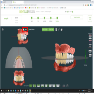 dima Print Digital Denture – Resin for 3D printed dentures