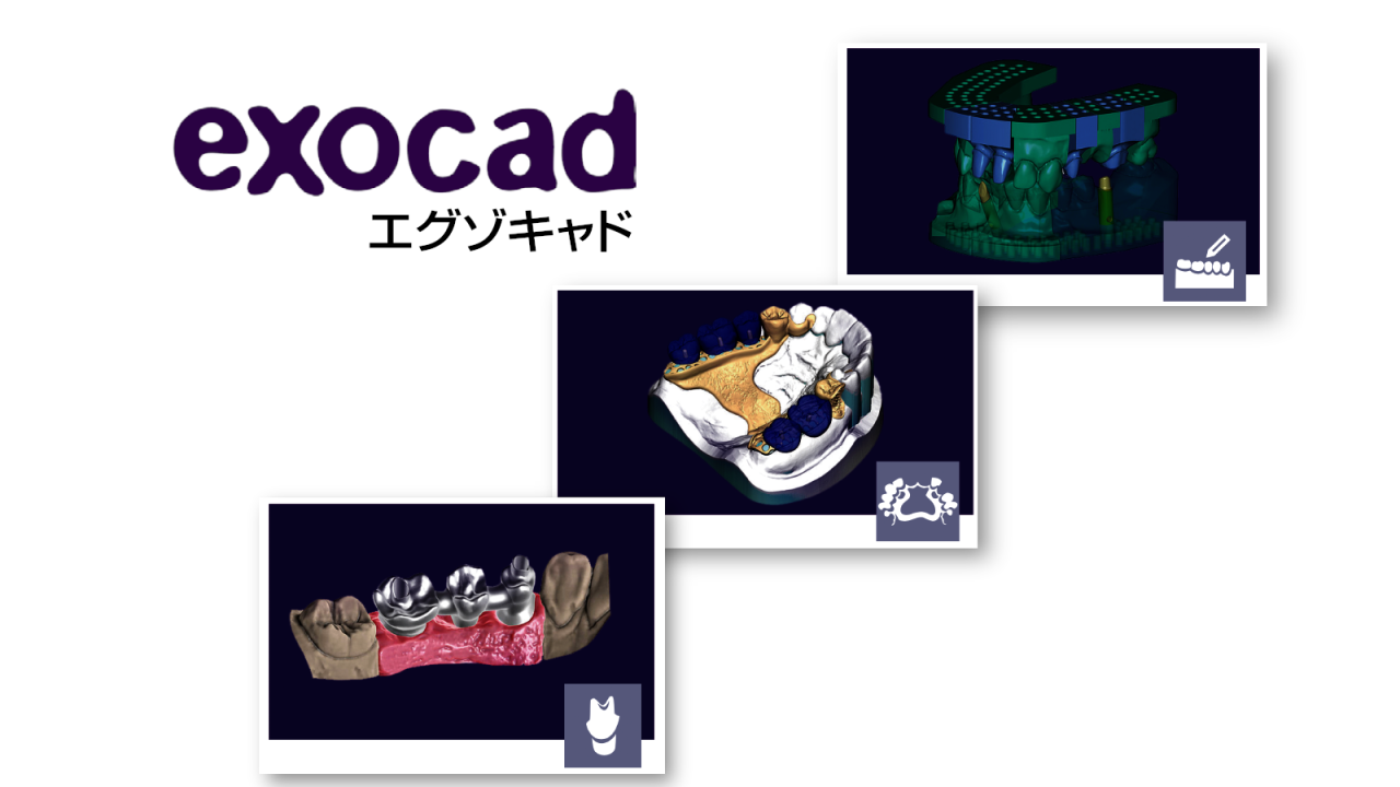 exocad(exocad社)